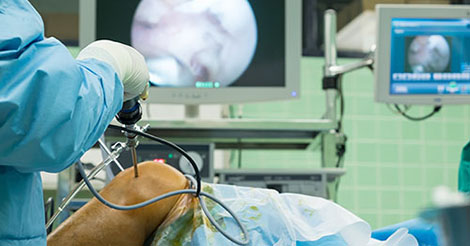 Arthroscopic surgery: One of the major advances in orthopedic surgery ...